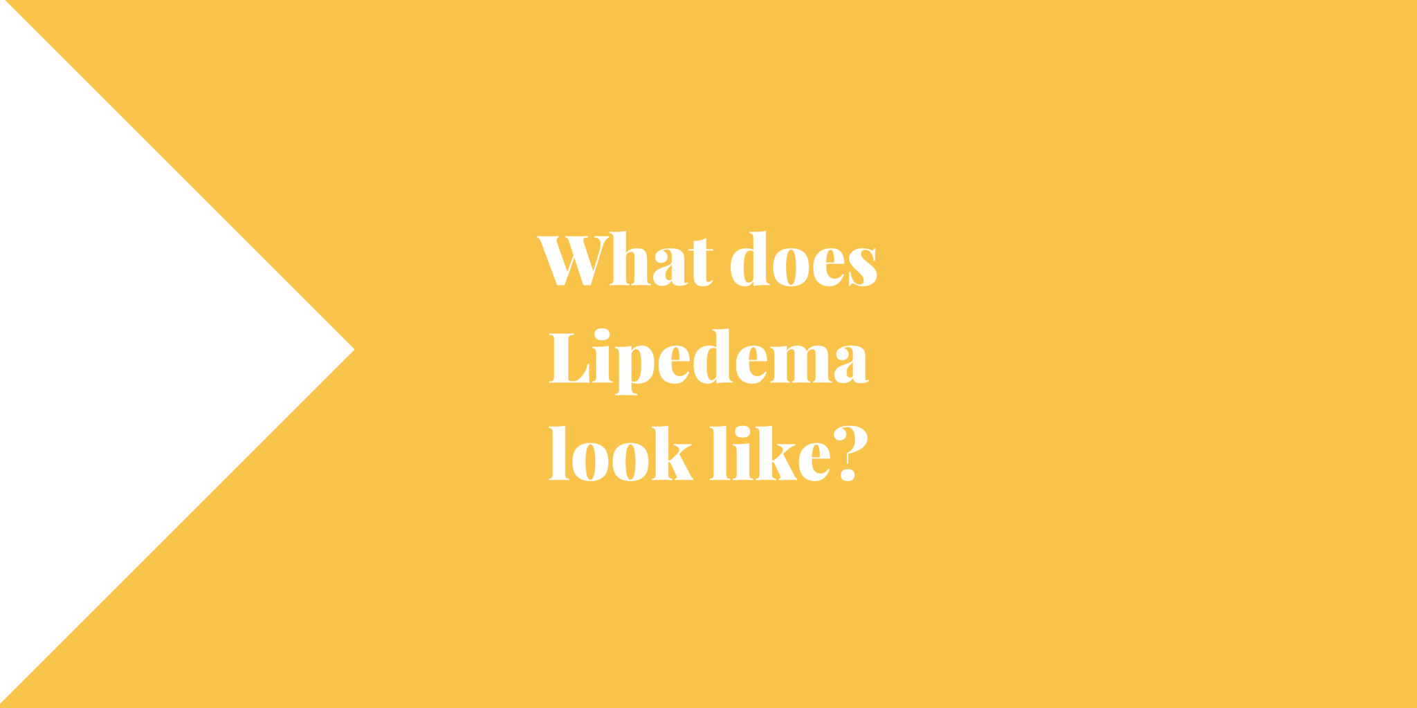 Blog - Lipedema and Me